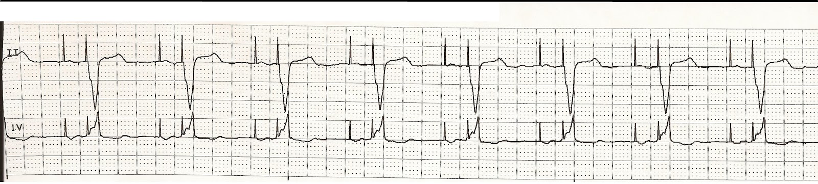 EKG Rhythm Strip Quiz 9