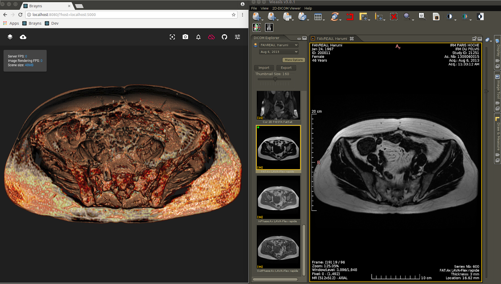 Large Scale & Interactive Scientific Visualization