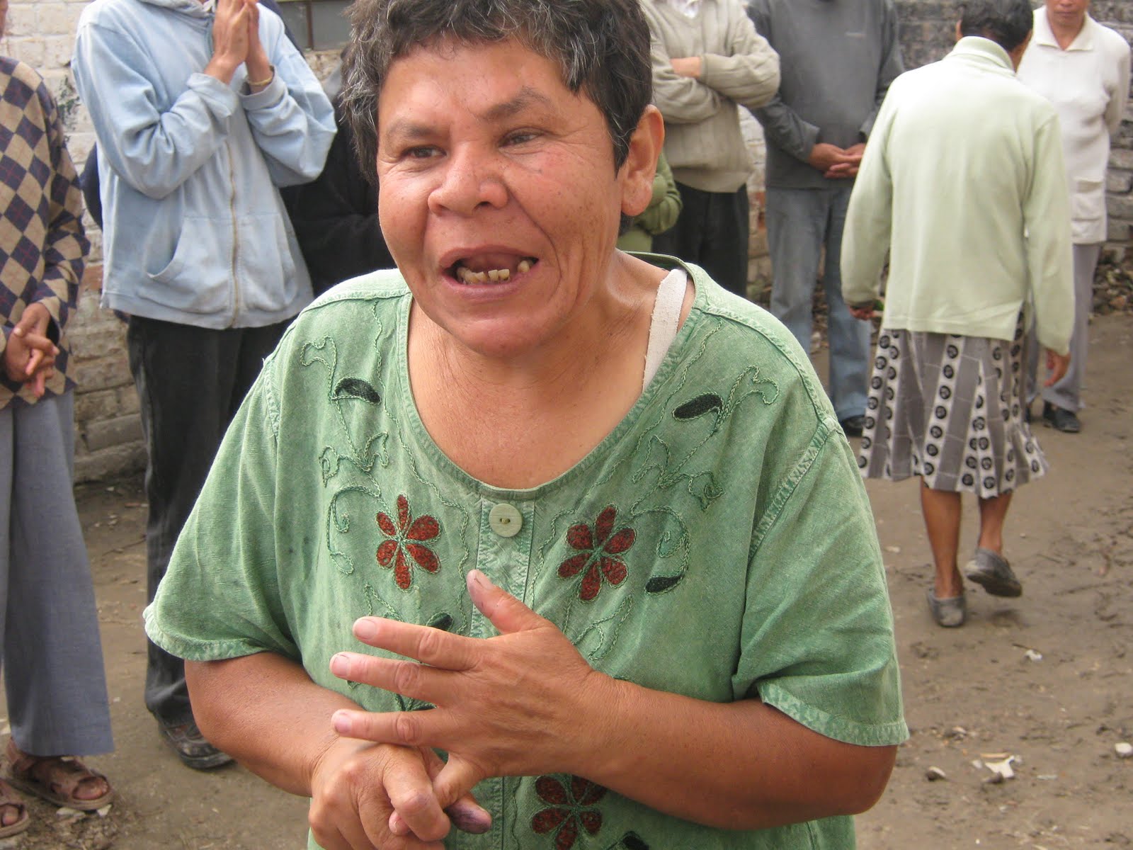 habilidades para el desarrollo de Procesos Basicos: Discapacidad mental