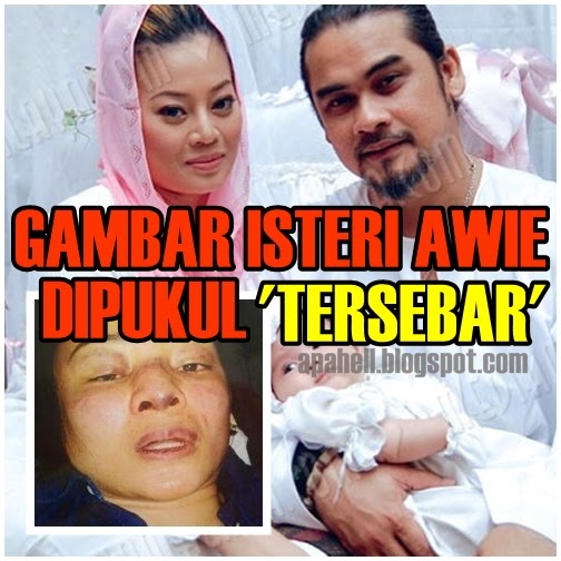 Gambar Isteri Awie Cedera Teruk Dipukul Tersebar (4 Gambar) - Ohsem meh!