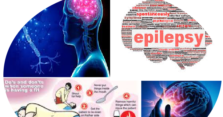 Live Ayurveda : What is Epilepsy?? How to get permanent rid by ...