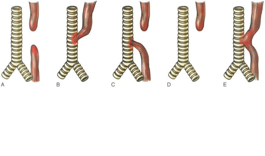 Florencia comisión 6 2013: Malformaciones congénitas