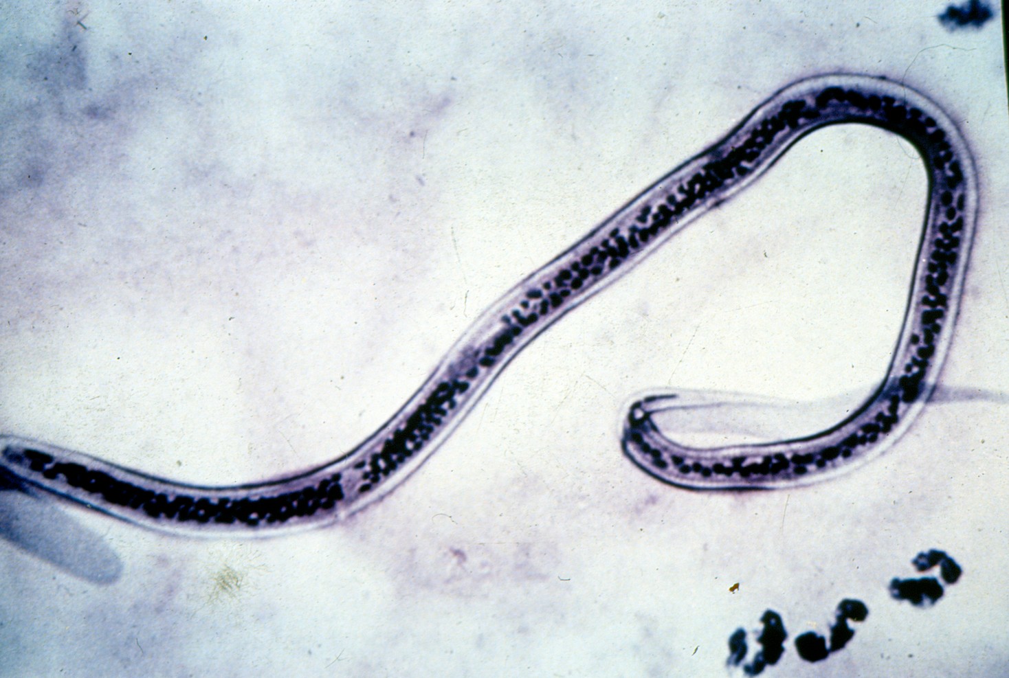 Wuchereria Bancrofti e a Filariose | Bio Mais