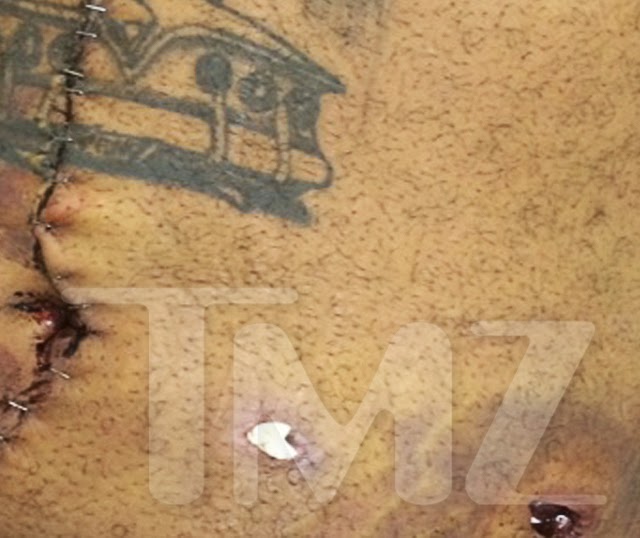 BREAKING HEADLINES: Creepy : Suge Knights Bullet wound is directly on a ...