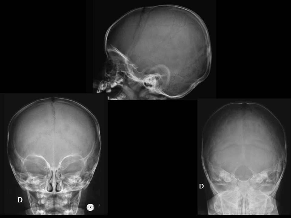 Tecnicos Radiologos: Protección Radiológica Pediátrica (Pediatric ...