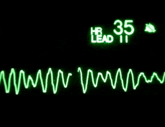 ELECTROCARDIOGRAFÍA BÁSICA PARA ENFERMERÍA: noviembre 2018