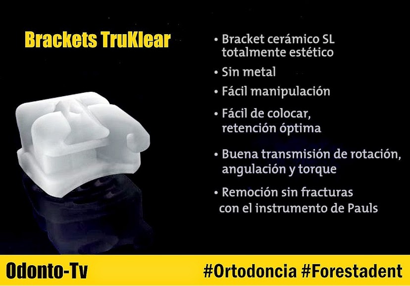 ORTODONCIA: Ventajas de los Brackets TruKlear Estéticos - Forestadent