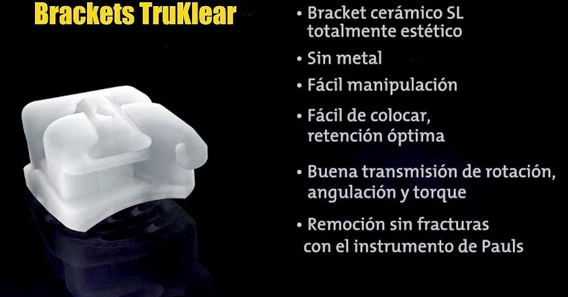 ORTODONCIA: Ventajas de los Brackets TruKlear Estéticos - Forestadent ...