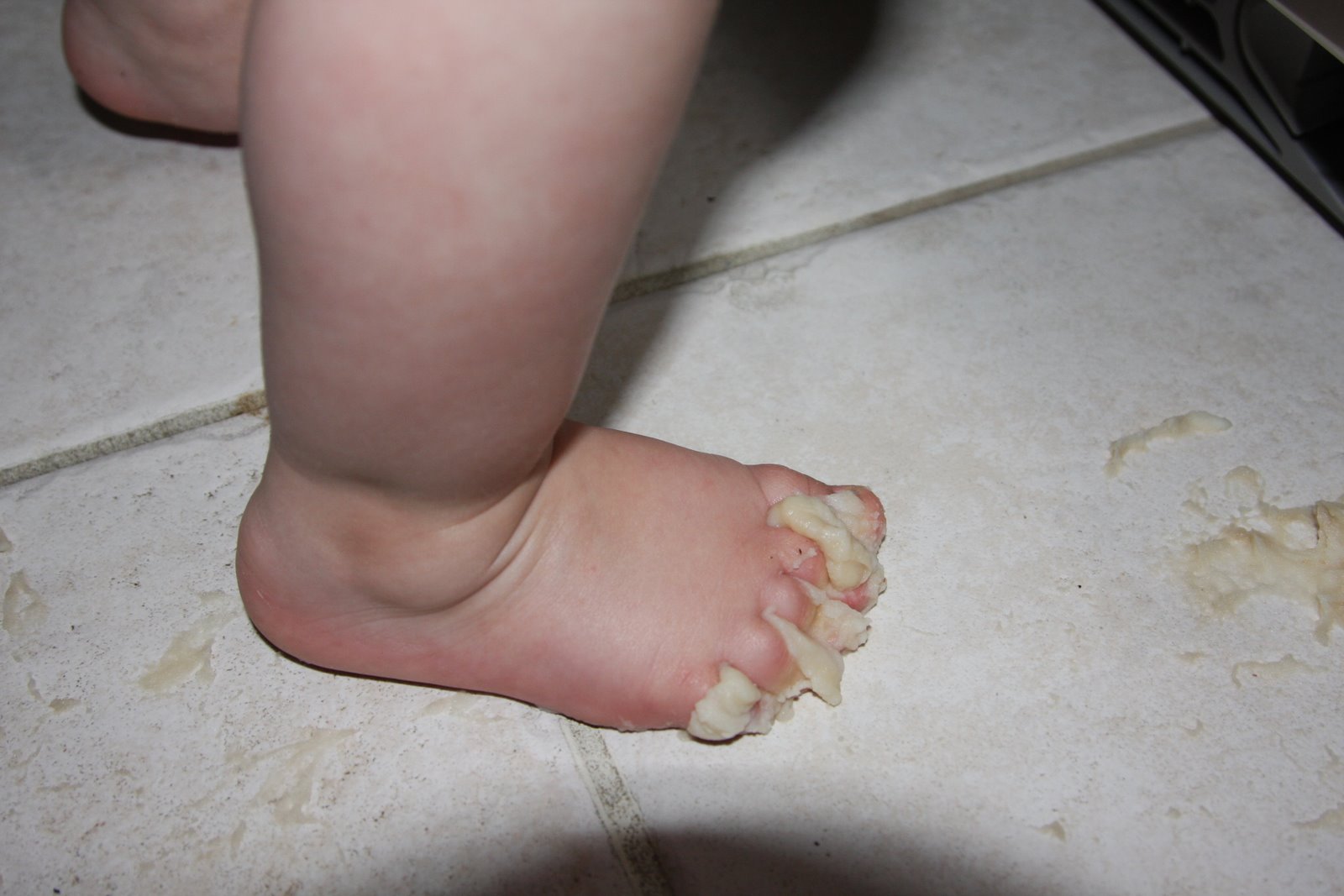 Potato On Baby Feet For Cold at Angela Milligan blog