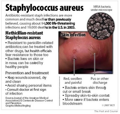 Allimed Research: MRSA Information
