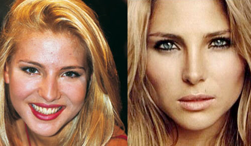 Zaza Words Music: "Lo que la cirugía les dejó..." Antes y después de ...