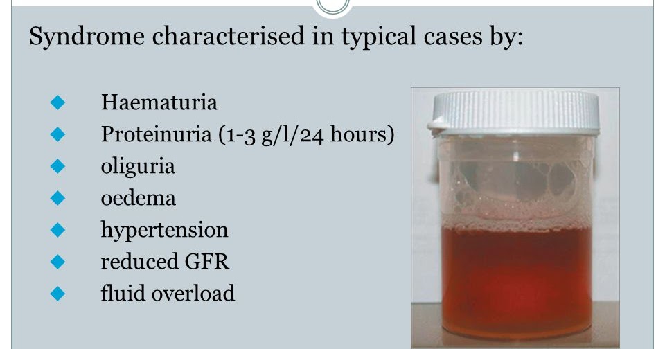 Prepare for Medical Exams : Most Common Cause Of Nephritic Syndrome In ...