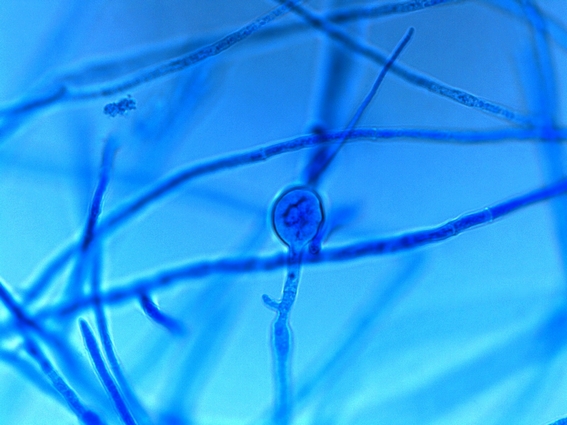 Fun With Microbiology (What's Buggin' You?): Trichophyton tonsurans