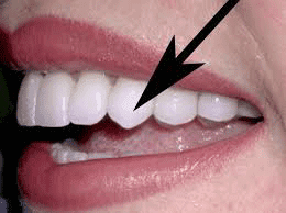 4 Tipos de dientes: CONOCE sus funciones y cuidados