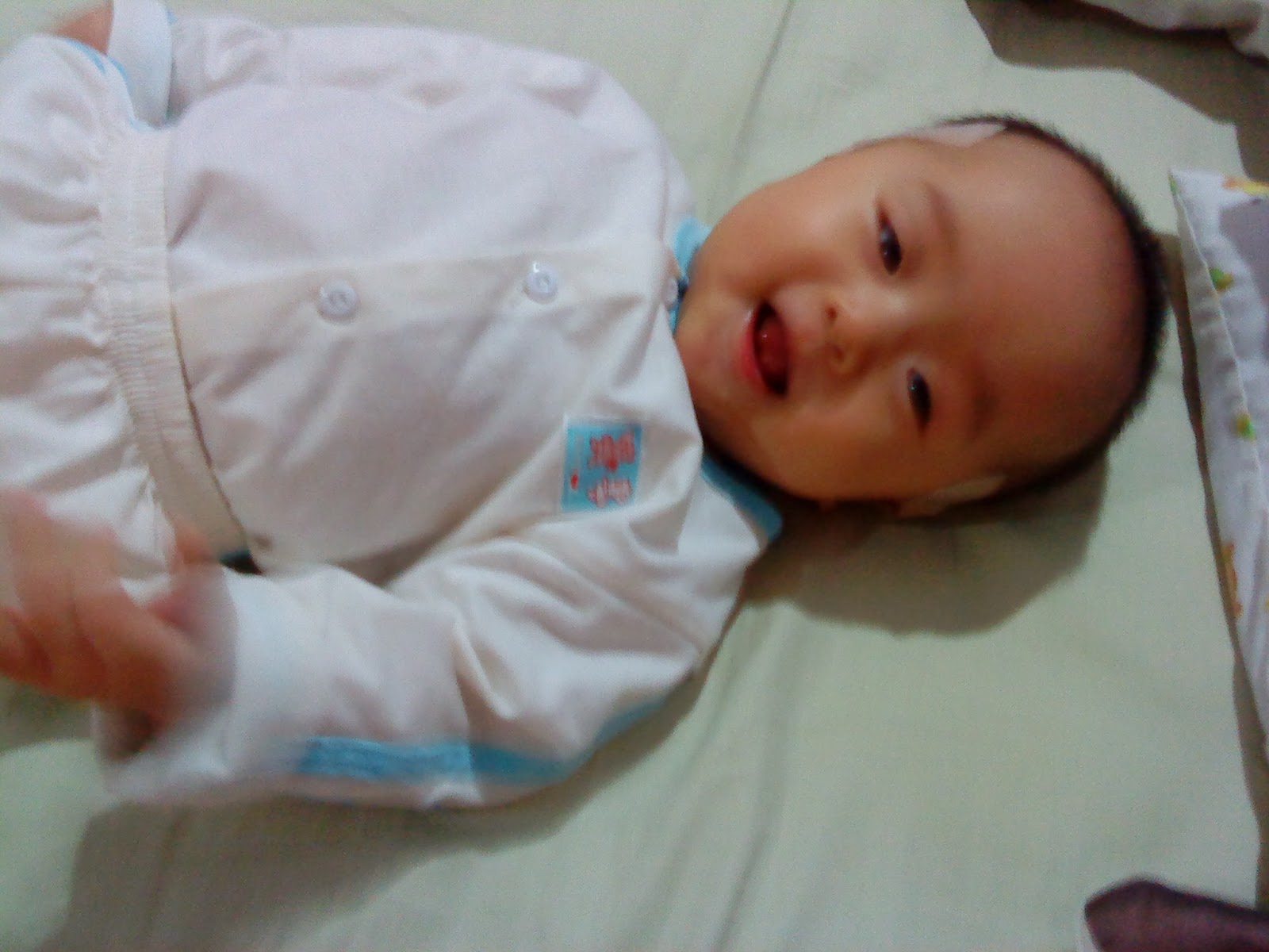 Cilipadi: Baby Ear splinting for Pointy Ears