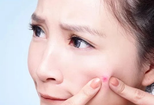 Pumpkin Seed Oil Acne Feedtheking pumpkin-seed-oil-acne-feedtheking