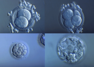 Incidence du milieu de maturation de l’ovocyte sur les premiers stades ...