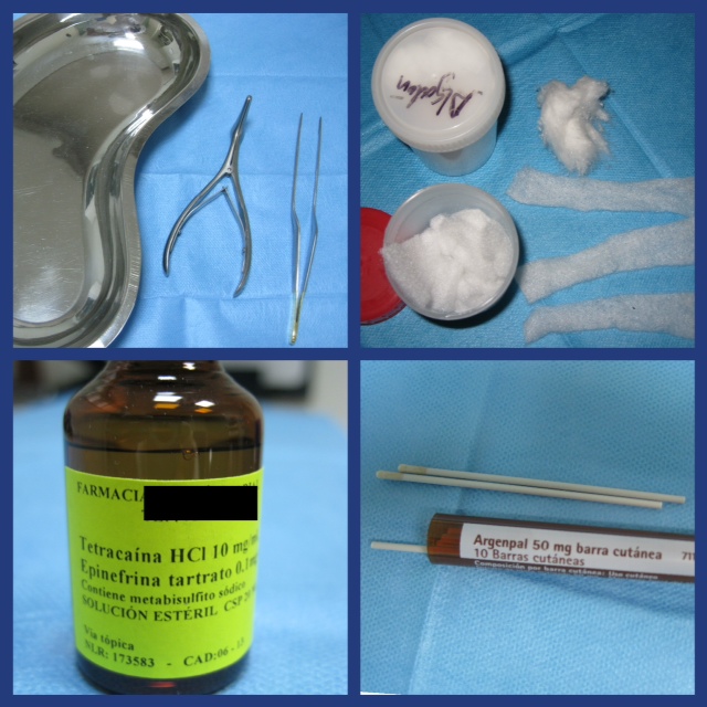 El OtoBlog: Epistaxis (I): Cauterización de la mucosa nasal con nitrato ...