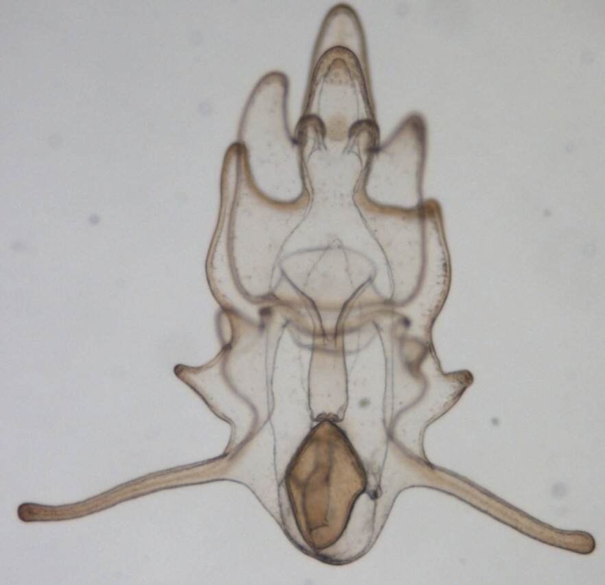 Invertebrate Embryology: Brachiolar arms in late-stage asteroid larvae