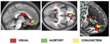 Thinking it: Semir Zeki and response of brain to visual stimuli