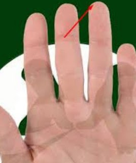 Ruas Jari Tangan Sakit - Jari Tangan Kaku Kesemutan dan Sakit