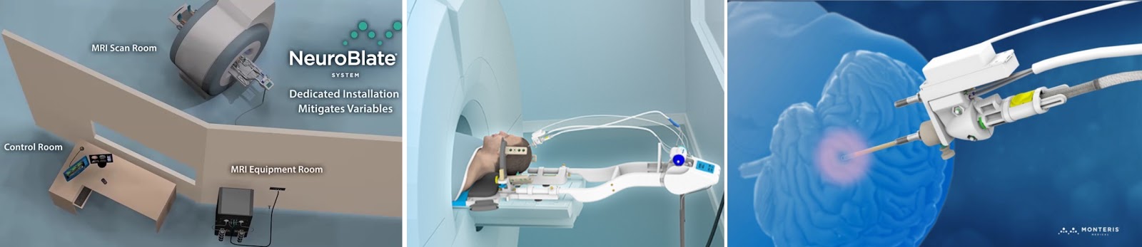 How Monteris Medical navigated a surgical robotics recall