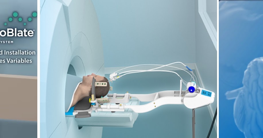 How Monteris Medical navigated a surgical robotics recall