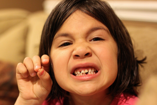 Life on Cedar Ridge: Ava loses a tooth...or two...