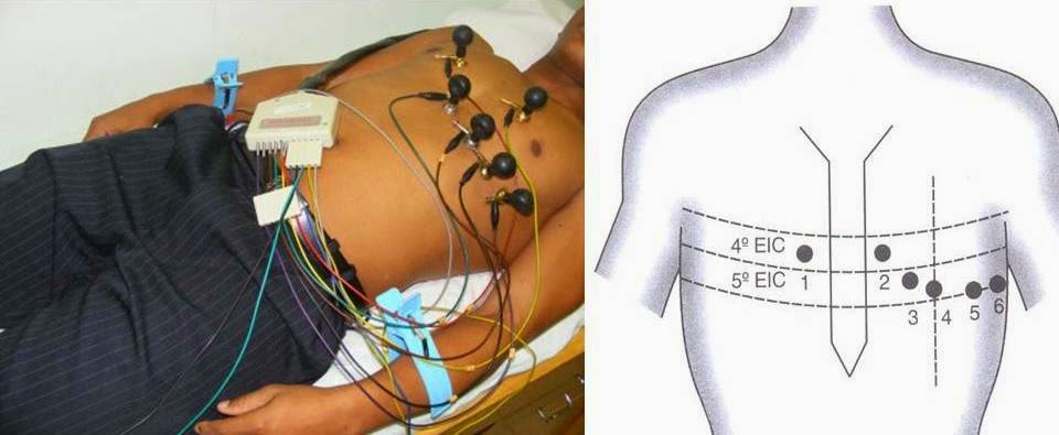 Eletrocardiograma - Enfermagem bio