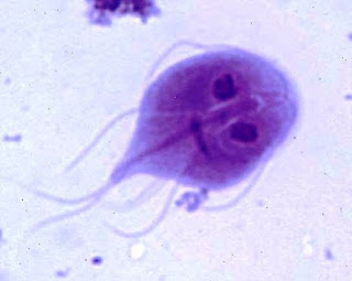 MundoETS: LA GIARDIA LAMBLIA