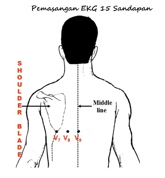 18+ Cara Pemasangan EKG, Inspirasi Yang Pas Untuk Hunian Anda