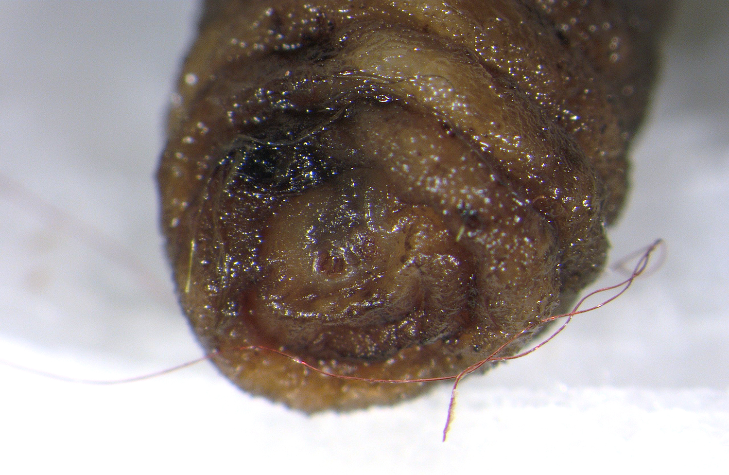 Creepy Dreadful Wonderful Parasites: Case of the Week 516