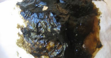 Gastrointestinal Hemorrhage in Cats