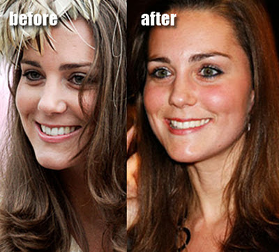 Kate Middleton Without Makeup