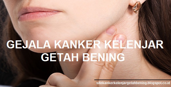 Apa Saja Ciri-ciri atau Gejala Kanker Kelenjar Getah Bening ? | KIRIM ...