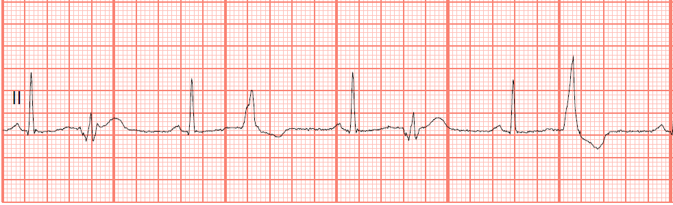 EKG Quiz 336