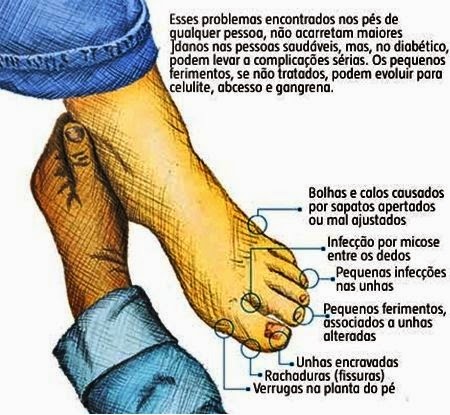 FISIOTERAPIA NO TRATAMENTO DE FERIDAS DRA. DANIELLE MIRANDA: DICAS PARA ...