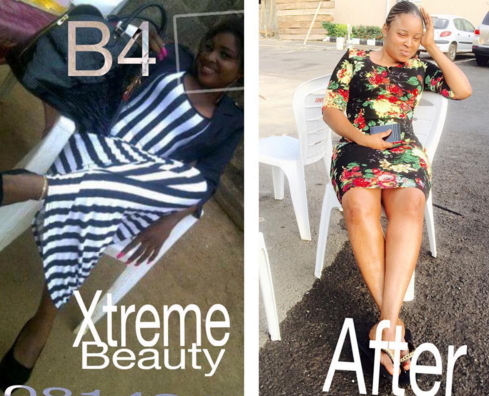 Black & Beautiful Nollywood Actress Abimbola Ogunnowo Opens Skin ...