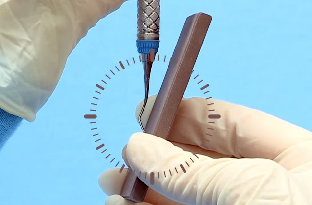 PERIODONTICS: Sharpening Gracey Curettes - Hu Friedy