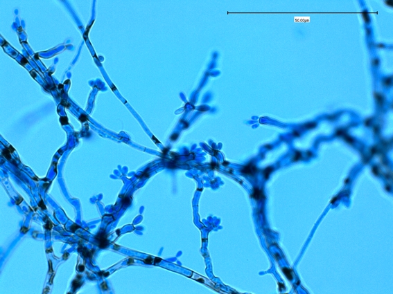 Fun With Microbiology (What's Buggin' You?): Fonsecaea pedrosoi/monophora