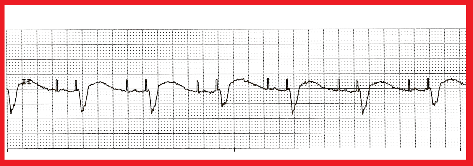 Practice Rhythm Strips 294