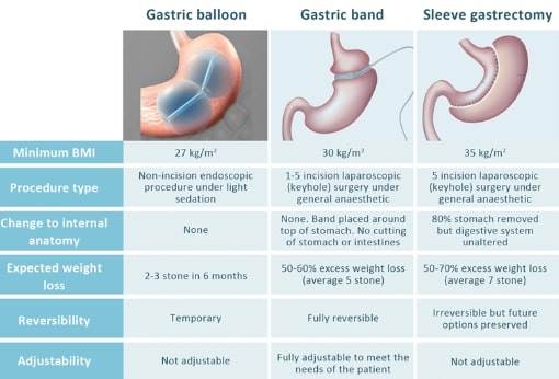 ESG weight loss - Endoscopic Sleeve Gastroplasty ~ Nutrition guide ...