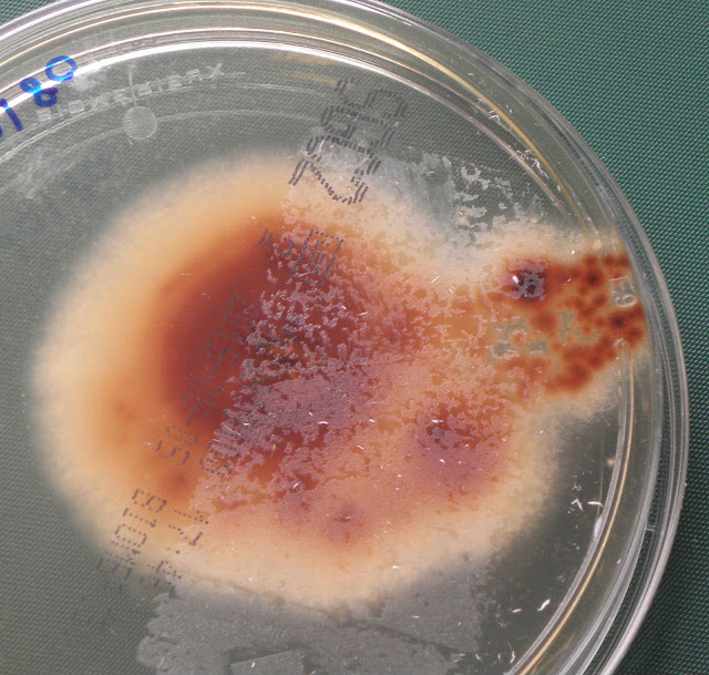 ATLAS MICOLOGIA: TRICHOPHYTON INTERDIGITALE