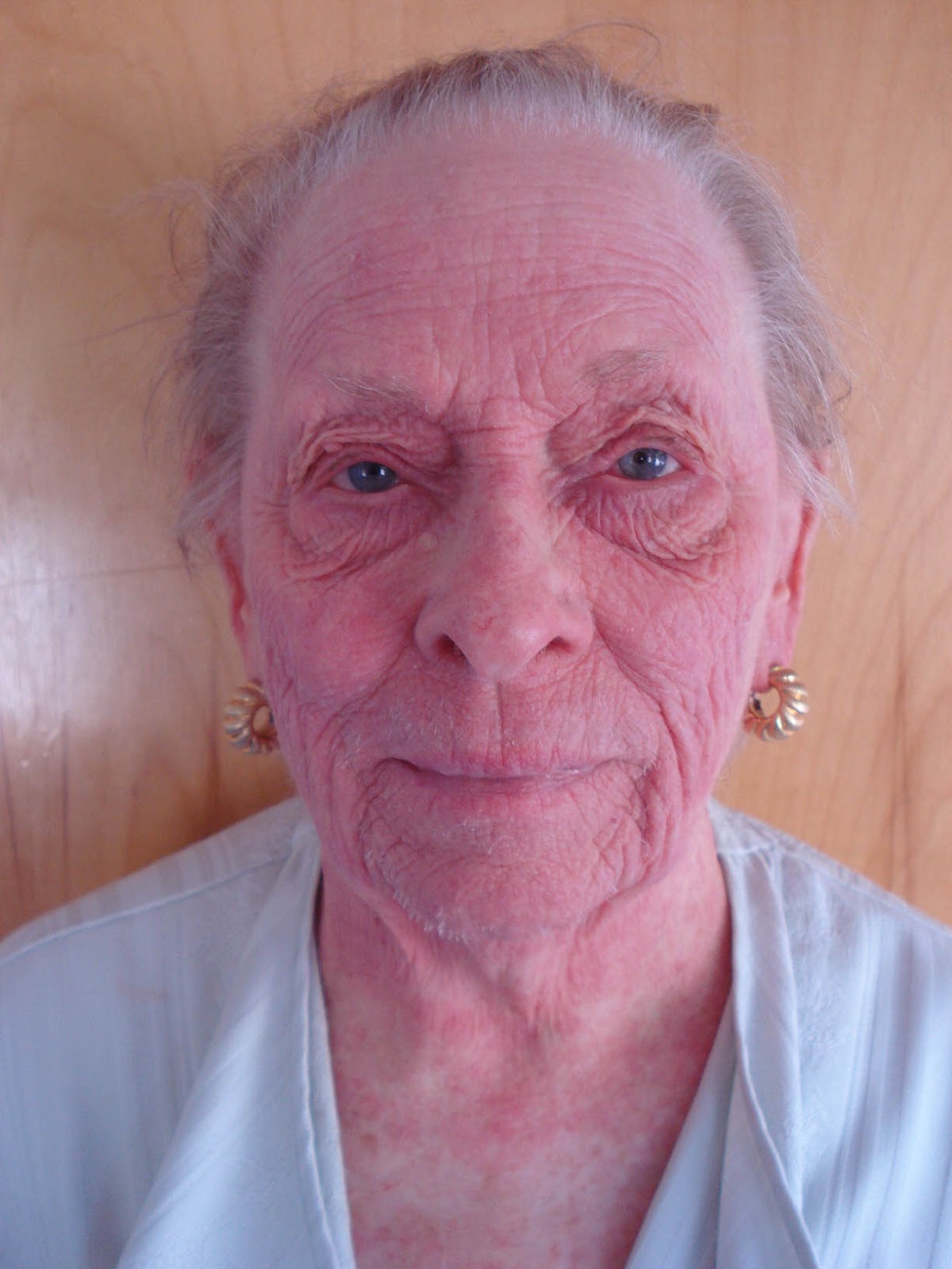 VIRTUAL GRAND ROUNDS IN DERMATOLOGY 2.0: September 2016