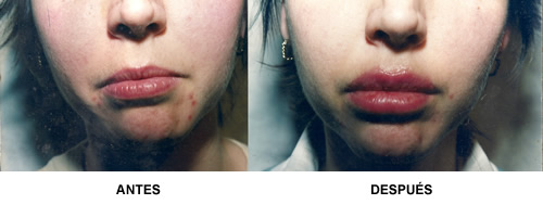 Cirugía plástica facial