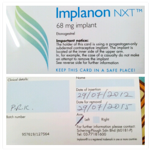 AufaZanKi: Pakai 'susuk'!