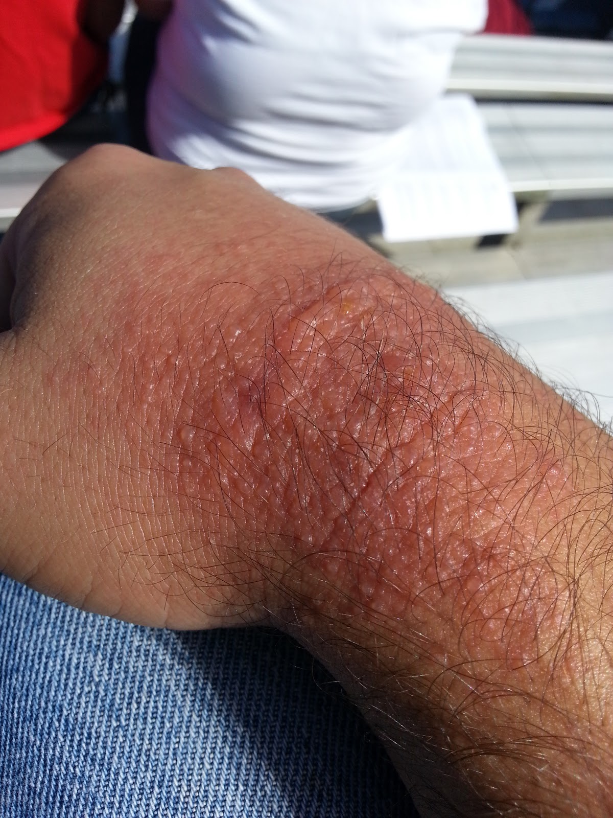 Duck Notes: I am Poisoned!