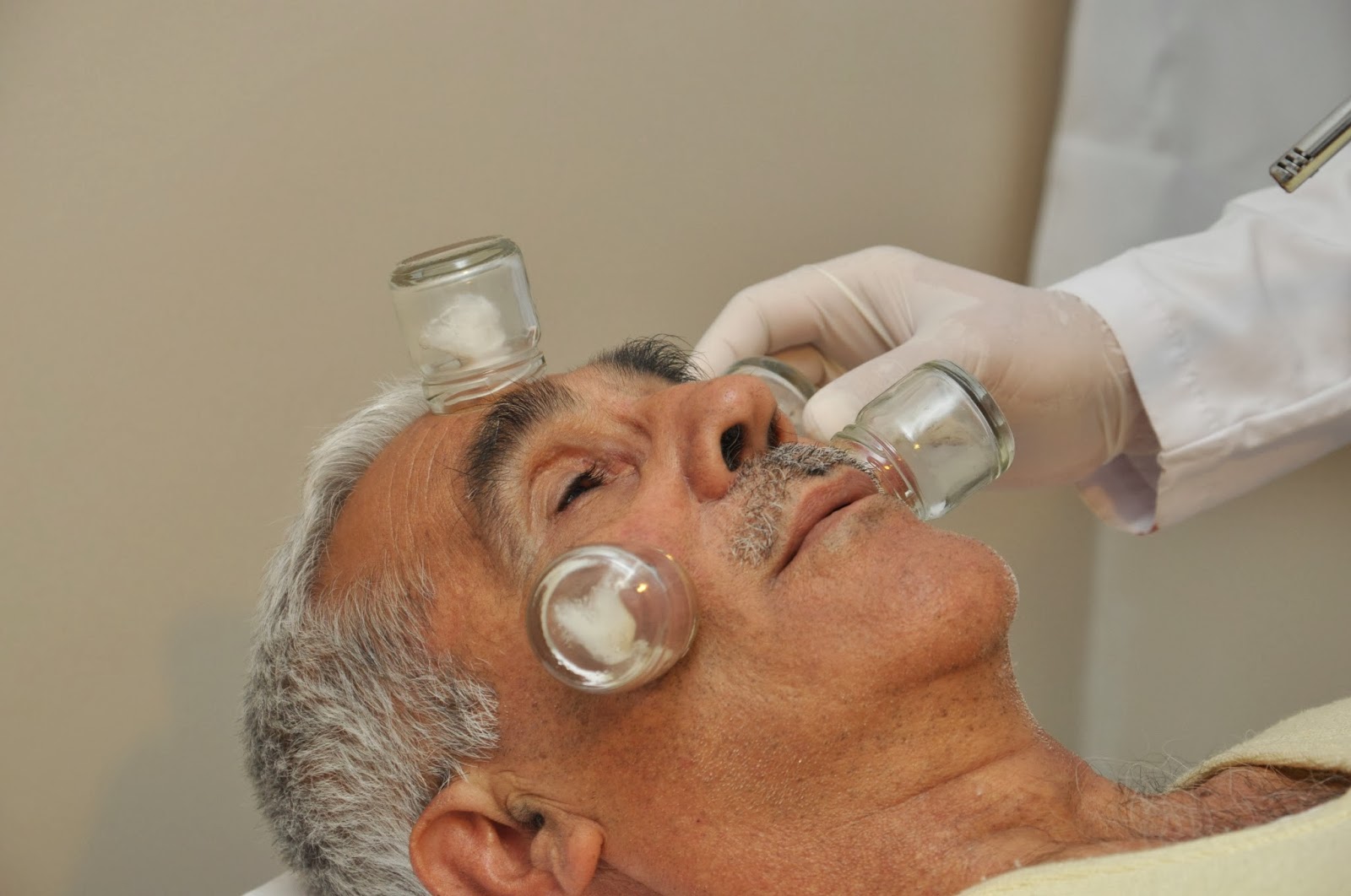 Cilt ve yüz bakımında tıbbi hacamat tedavileri / Sağlıklı Yaşam ...