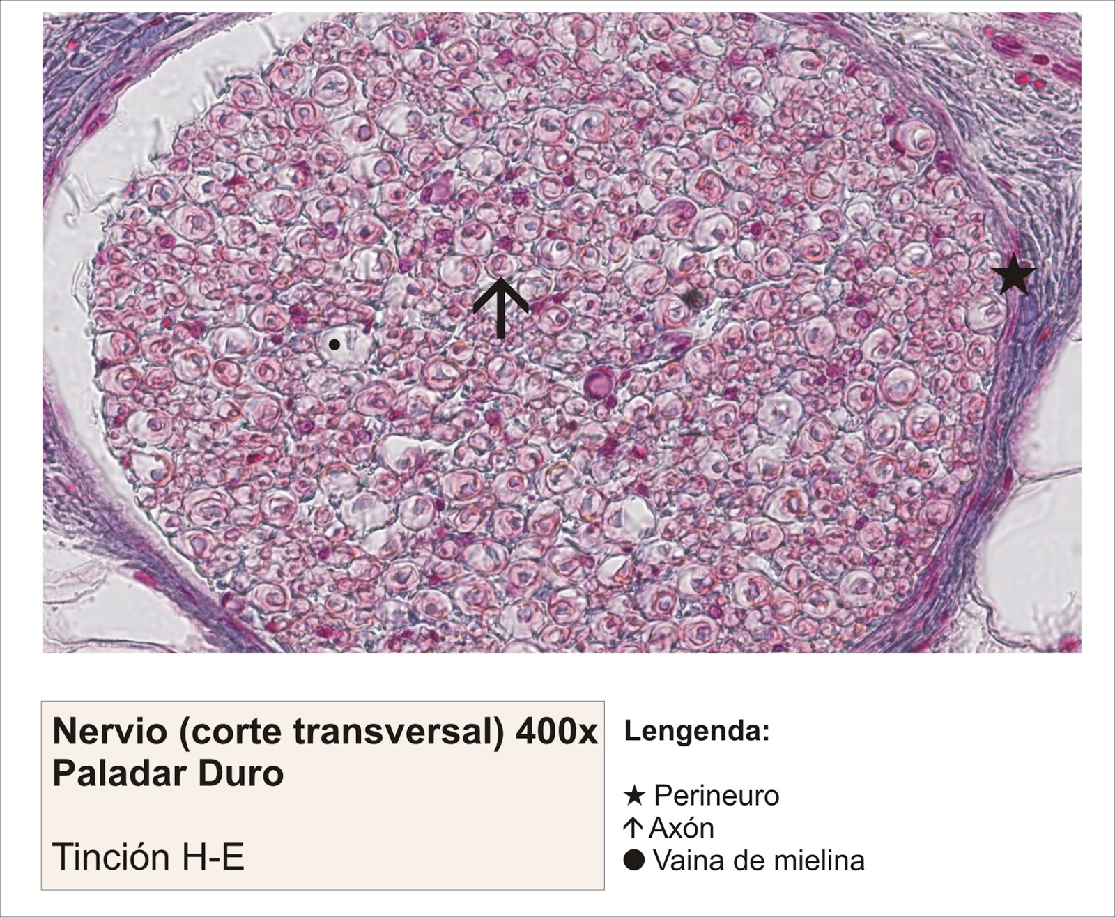 Riánsares' blog: Paladar Duro. Nervio (Corte transversal)