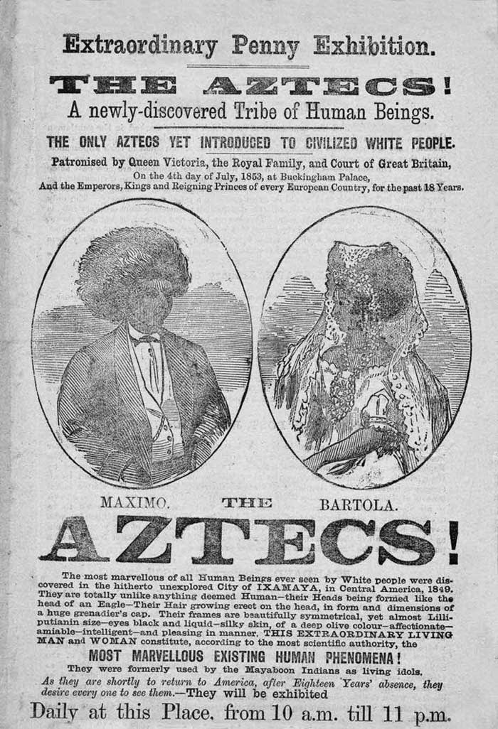 Morbid Anatomy: Dental casts of the Extraordinary Aztec Children, 1853 ...